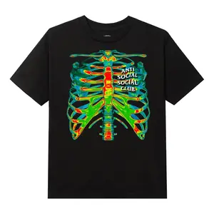 ANTI SOCIAL SOCIAL CLUB Blow To The Chest Tee 'black