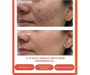 BEJOU Clear Confidence Moisturizer