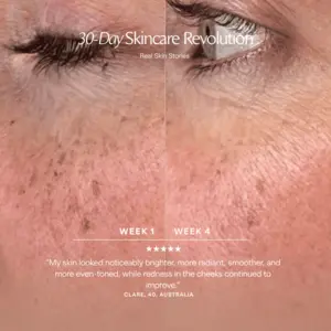 PROJECT E BEAUTY Lumalux Dome Face & Body Led Light Therapy Device
