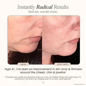 PROJECT E BEAUTY Skinsonic Led Ultrasonic Wand