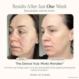 PROJECT E BEAUTY Reva Instant Age Renewal Wand