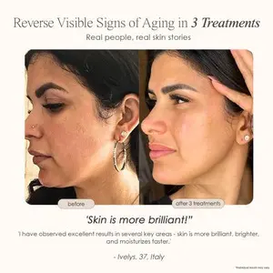 PROJECT E BEAUTY Reva Instant Age Renewal Wand