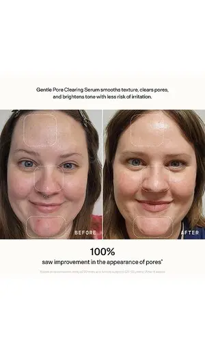 VERSED Skin Refine Gentle Pore Clearing Serum