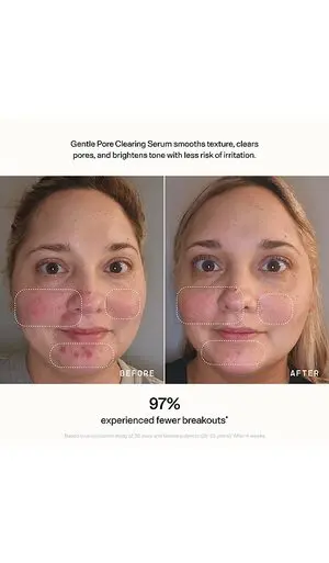 VERSED Skin Refine Gentle Pore Clearing Serum