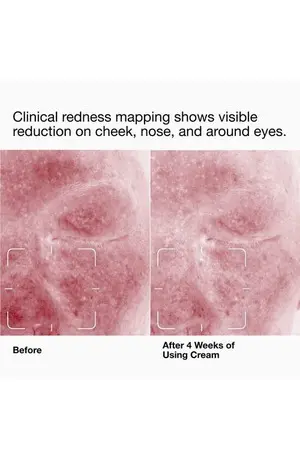 CLINIQUE Daily Calm™ Soothing Repair Cream