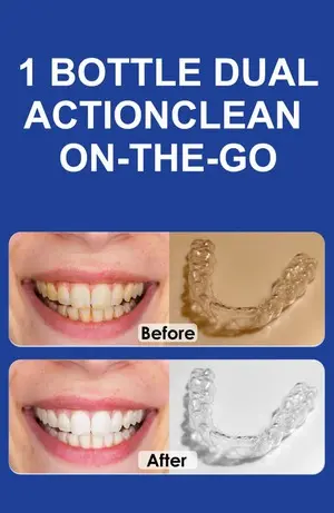 MYSMILE 2-in-1 Aligner Cleaner & Ning Foam