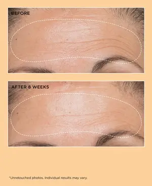 PERRICONE MD Neuropeptide Firming Facial Concentrate