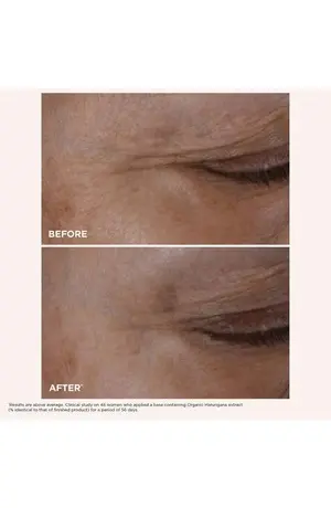 Clarins Total Eye Lift Eye Cream & Refill Set $173 Value