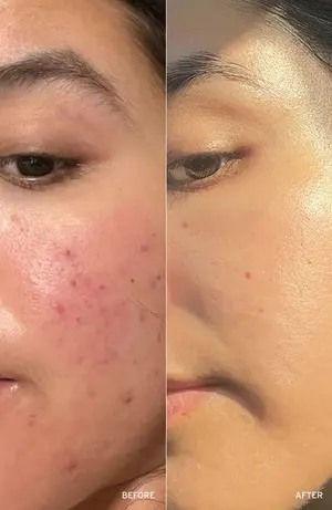 ARAMORE SKINCARE Nad+ Renew & Restore Bundle