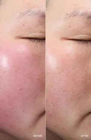 ARAMORE SKINCARE Nad+ Renew & Restore Bundle