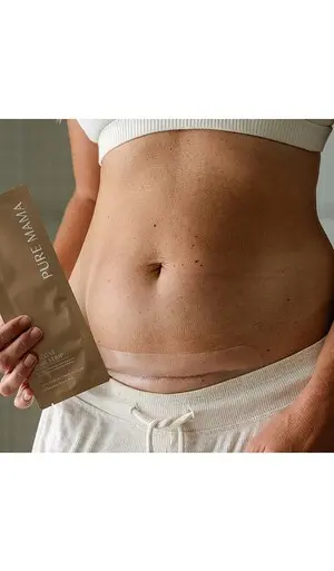 PURE MAMA Silicone Scar Strip