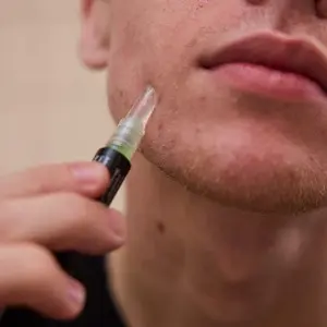 TIEGE HANLEY Acne Gel Pen