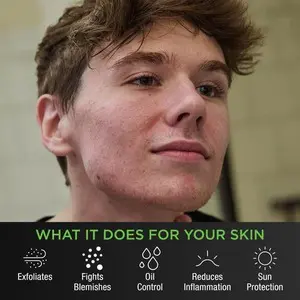 TIEGE HANLEY Level 2 Tiegeclear Acne Advanced Routine