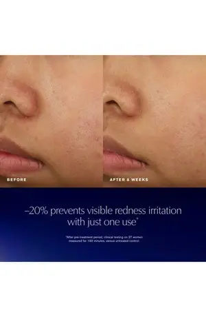 Estée Lauder Advanced Night Repair Recovery Treatment Essence