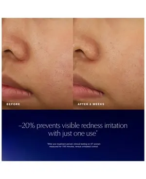 Estée Lauder Advanced Night Repair Recovery Treatment Essence 3.4 Oz