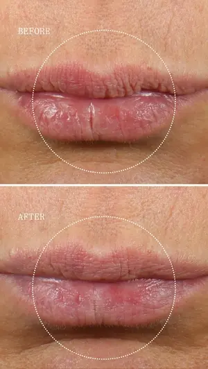 DR. MARNIE Lip Serum 0.1 Oz/3.7 - Clear