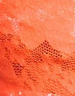 Balenciaga Fluorescent Lace Triangle Bra