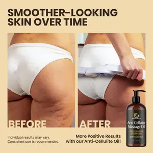 M3 Anti-cellulite Massage Roller