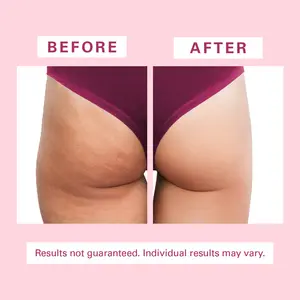 M3 Anti-cellulite Silicone Body Brush