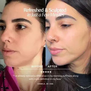 PROJECT E BEAUTY Cryo Ice Roller