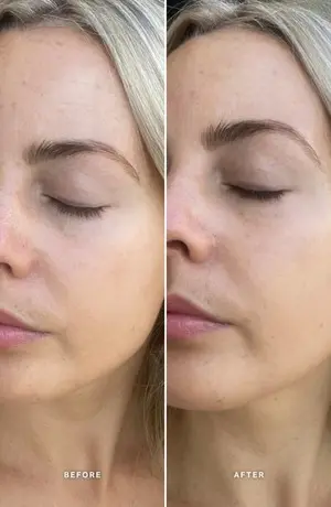 ALPHA-H Vitamin E Serum With 1% Ceramide Complex