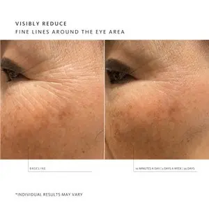 LA LUER Facial Treatment System Pro Device