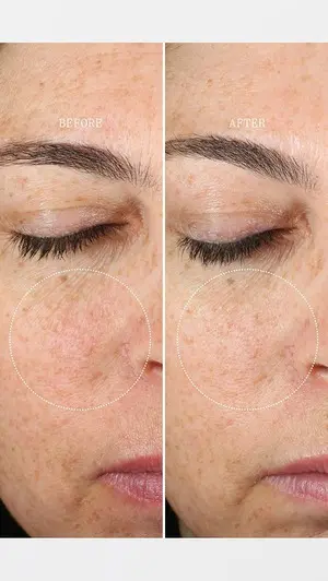 DR. MARNIE Facial Serum