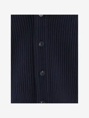 Vince V-neck Button-up Cardigan