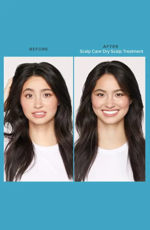 Living Proof Scalp Care Dry Scalp Treatment - No Color