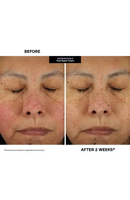 Kate Somerville® Kateceuticals® Total Repair Cream