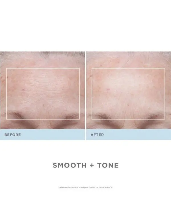 NuFACE Trinity Wrinkle Reducer Attachment