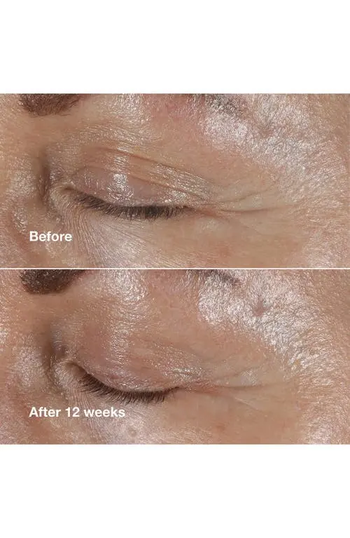 CLINIQUE Smart Clinical Repair Wrinkle Correcting Eye Cream