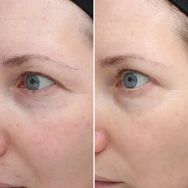 COLORESCIENCE Total Eye 3-in-1 Renewal Spf 35