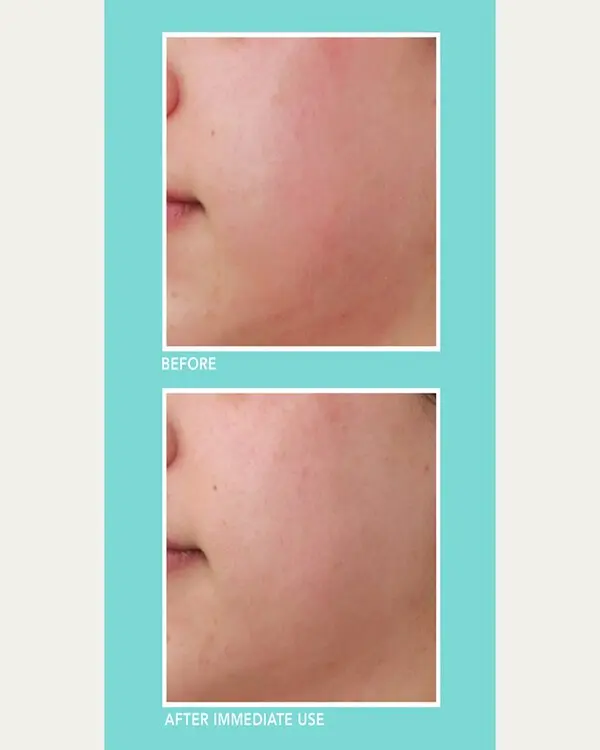 LANCER SKINCARE Soothe And Hydrate Serum, 1 Oz