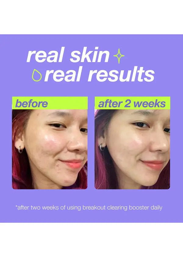 DERMALOGICA Breakout Clearing Booster Cleansers, Skin-soothing - Na