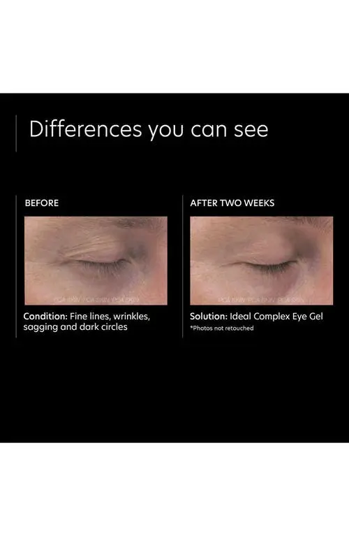 CAY SKIN Ideal Complex Revitalizing Eye Gel - No Color