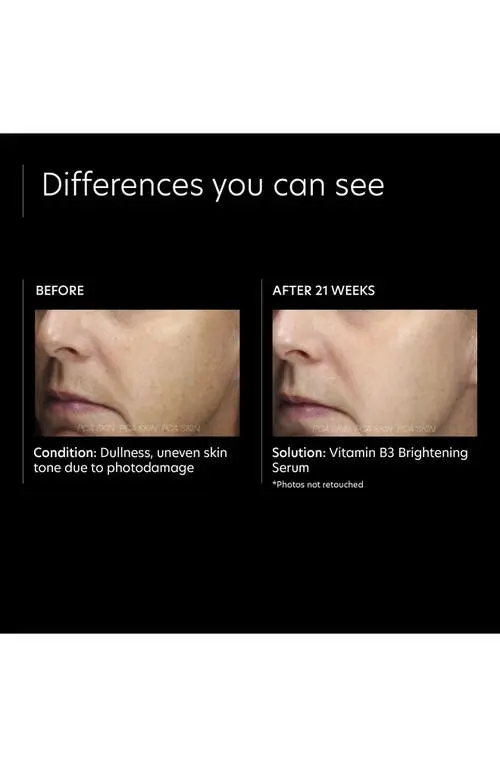 PCA SKIN Vitamin B3 Brightening Serum - No Color