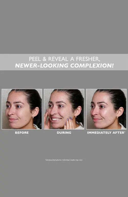 PETER THOMAS ROTH Firmx® Peeling Gel - No Color