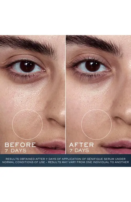 LANCOME Advanced Génifique Youth Activating Concentrate - No Color