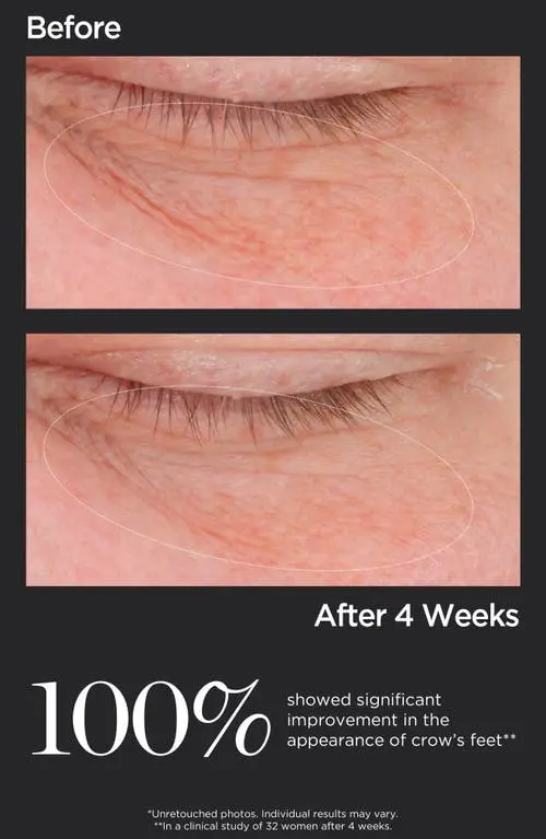 PERRICONE MD Cold Plasma+ Eye