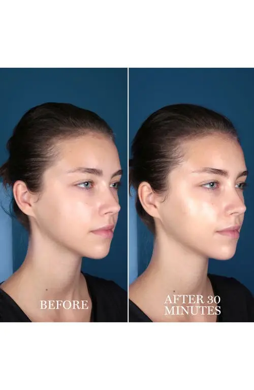 LANCOME Advanced Génifique Hydrogel Melting Sheet Mask