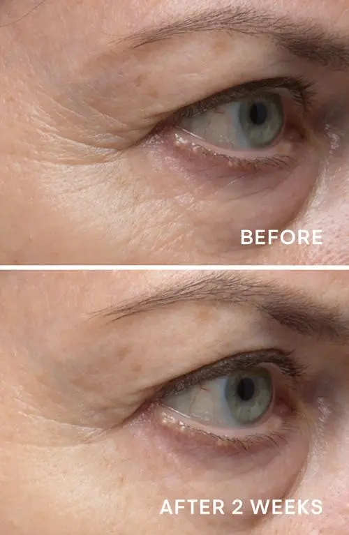 Elemis Pro-collagen Eye Revive Mask - No Color