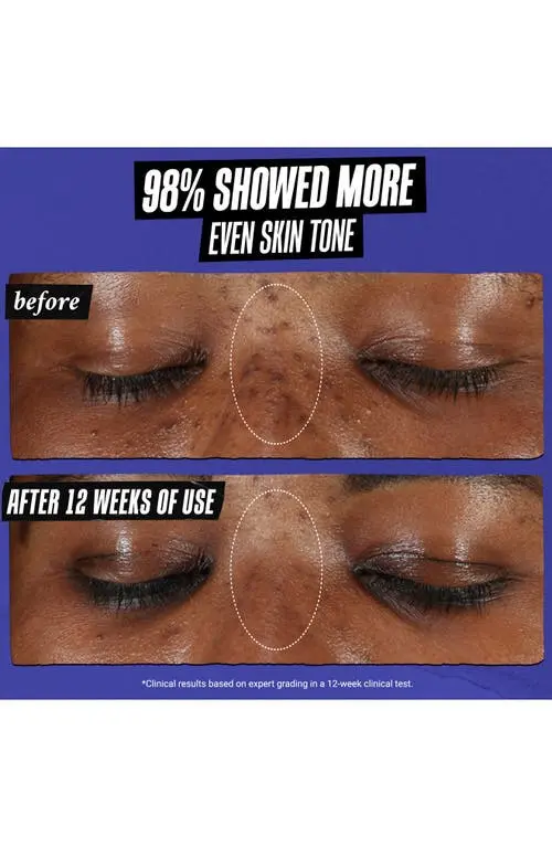 KIEHL'S SINCE 1851 Clearly Corrective™ Dark Spot Solution Face Serum - No Color