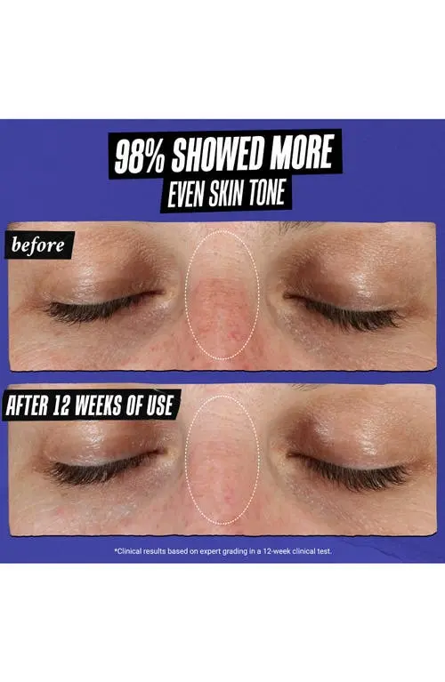 KIEHL'S SINCE 1851 Clearly Corrective™ Dark Spot Solution Face Serum - No Color