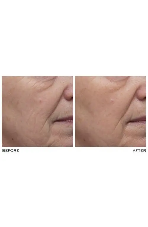 Elemis Ultra Smart Pro-collagen Aqua Infusion Mask