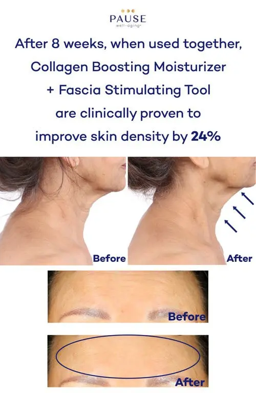 PAUSE Fascia Stimulating Tool