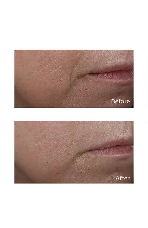 PERRICONE MD Cold Plasma Plus+ Advanced Serum Concentrate - No Color