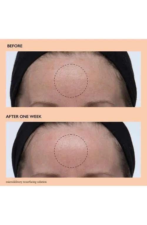 PHILOSOPHY Microdelivery Resurfacing Solution - No Color