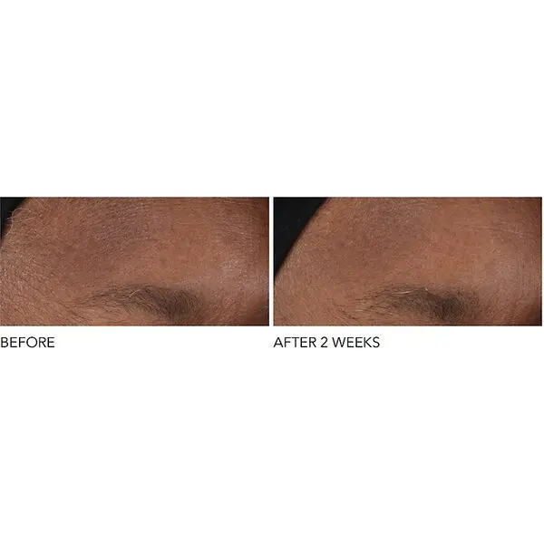 DR. DENNIS GROSS SKINCARE Advanced Retinol + Ferulic Overnight Wrinkle Treatment