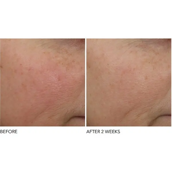 DR. DENNIS GROSS SKINCARE Advanced Retinol + Ferulic Overnight Wrinkle Treatment